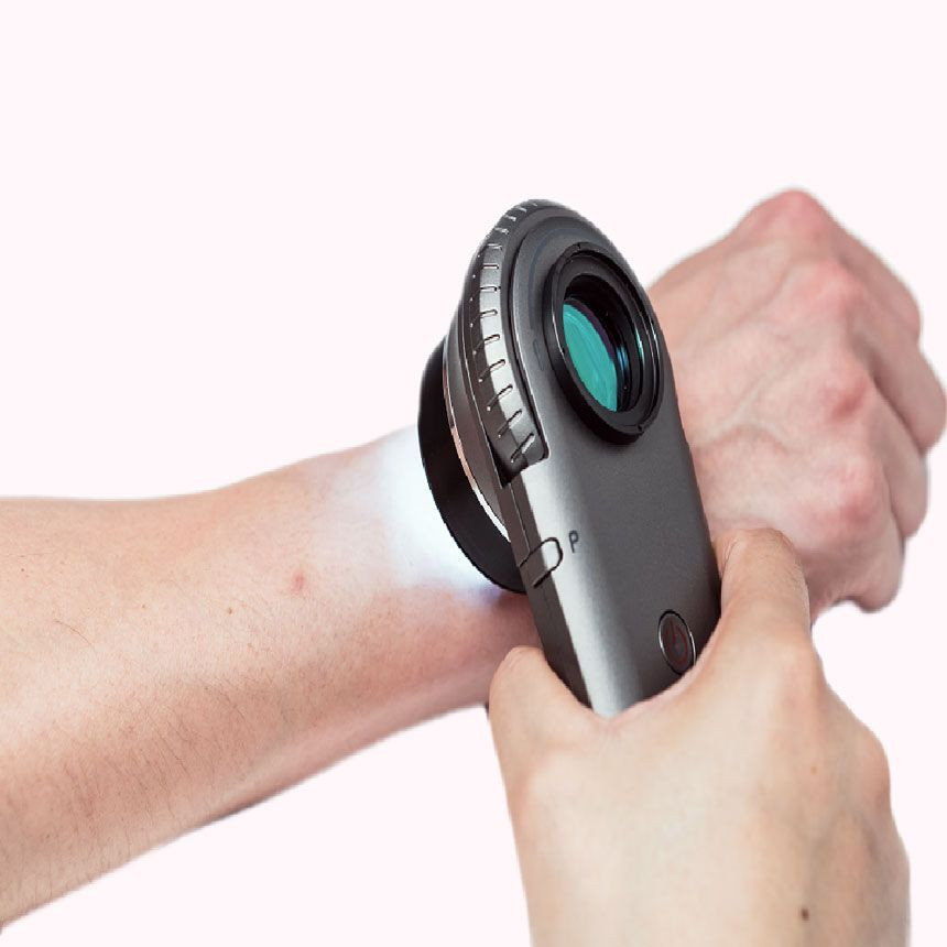 Buy Illuco Led Dermatoscope With Polarized Light Illumination from ...