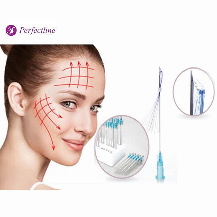 Buy Pdo Pcl Lifting Thread For Skin Lifting from Hangzhou Yanfeng ...