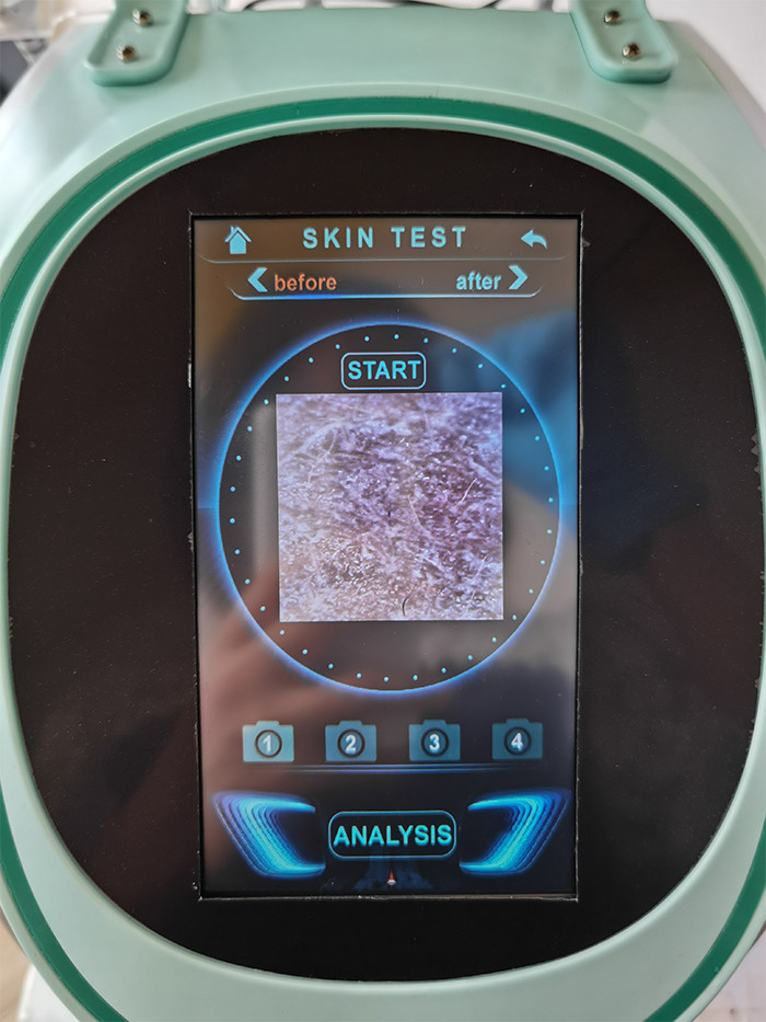 Buy 9 In 1 H202 H2o2 Hydrogen Oxygen Spray Water Jet Peel Spray Water ...