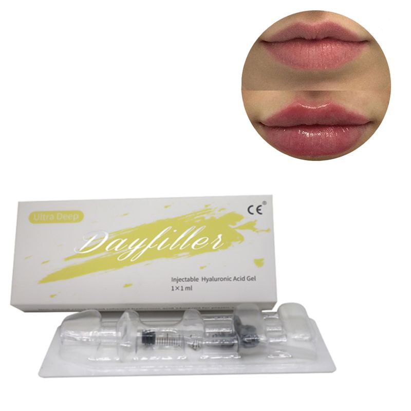 Buy Derm Lines Facial Anti-aging Lip Augmentation Dermal Filler Hyalgan ...