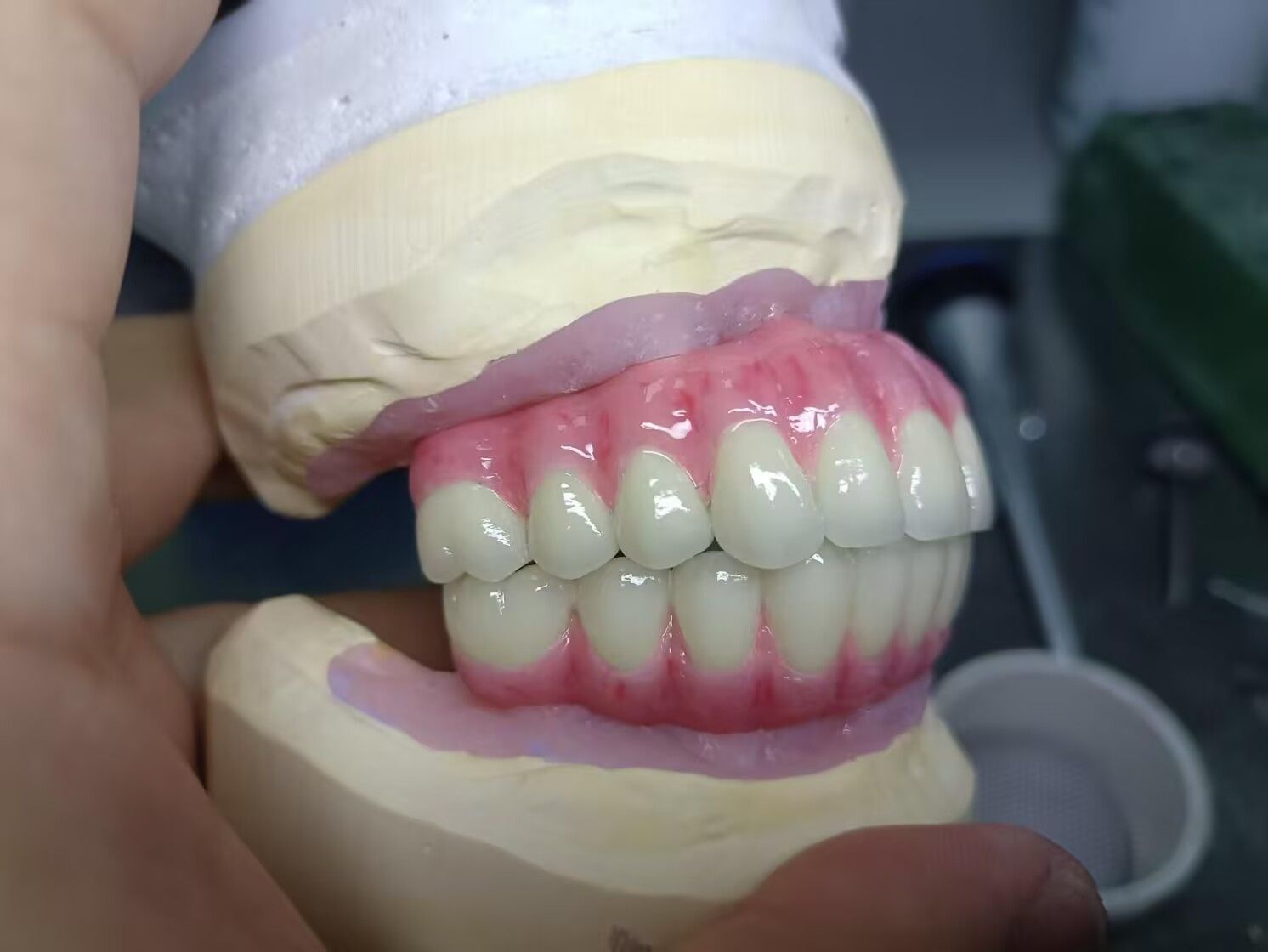 Buy Cement Implant Crown And Bridge Chinese Dental Lab from Shenzhen ...