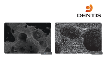 Buy Avos Bone Ha from Dentis, South Korea | Tradewheel.com