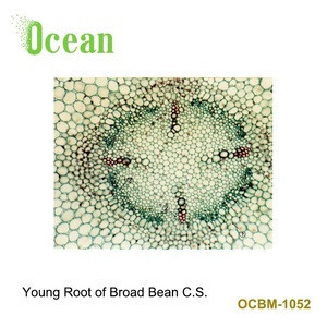 Buy Young Root Of Broad Bean C.s. Medical Science Subject And ...