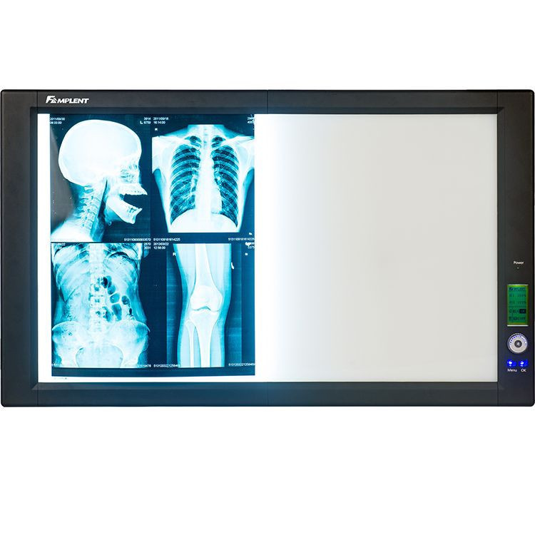 Buy Led Medical X-ray Film Viewer,negatoscope Led Slim View Box from ...