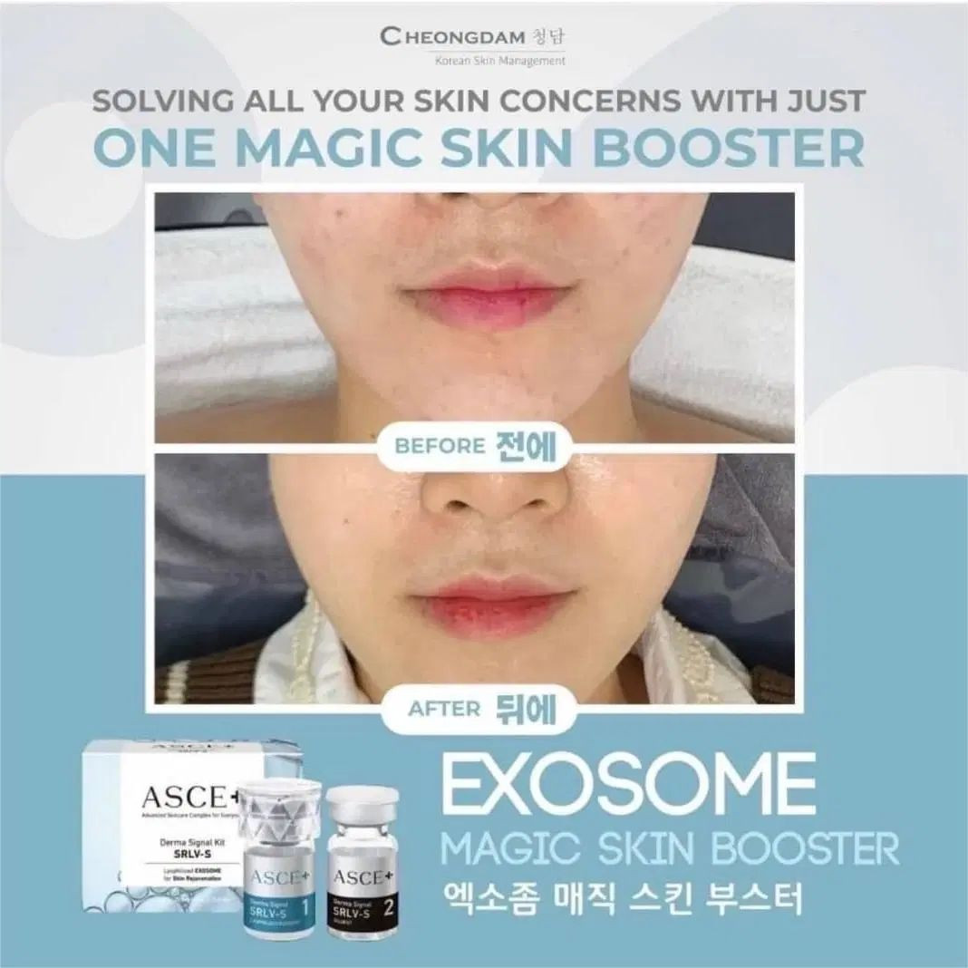 Buy Asce Exosome Powder For Face And Scalp from Remarss technology Co ...