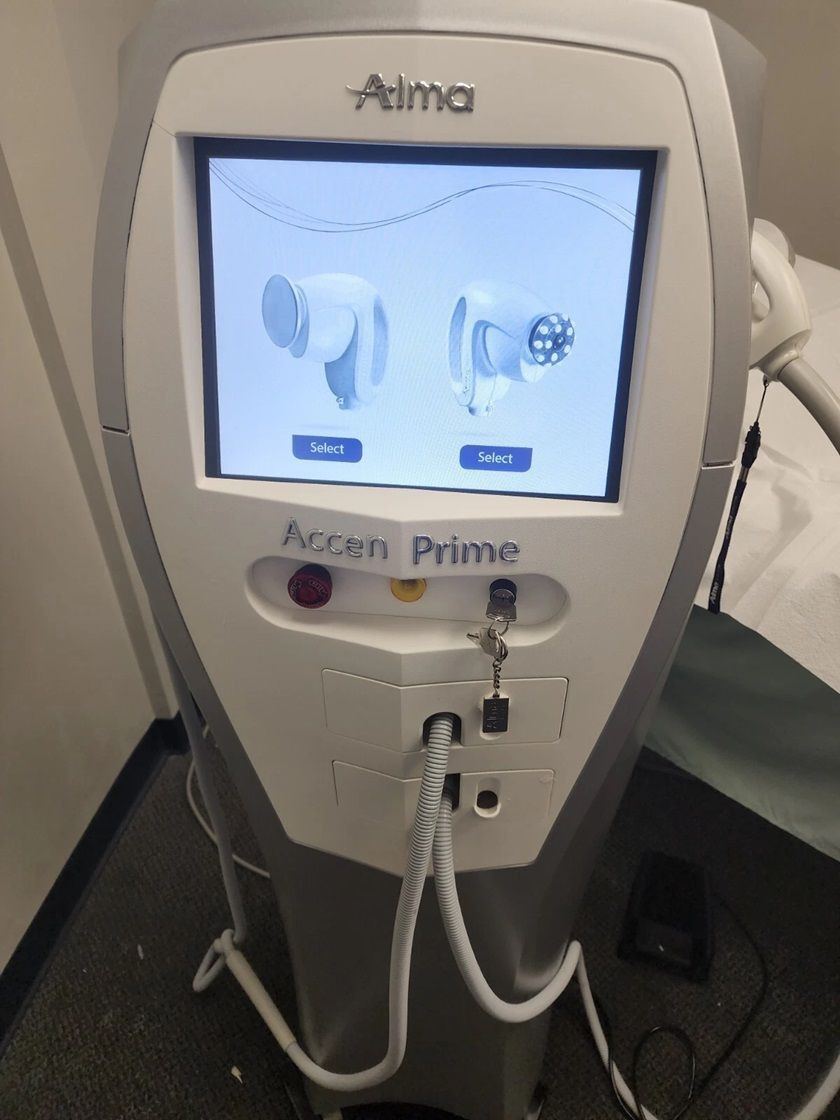 Buy Used 2020 Alma Accent Prime Body Contouring Device from Asence ...
