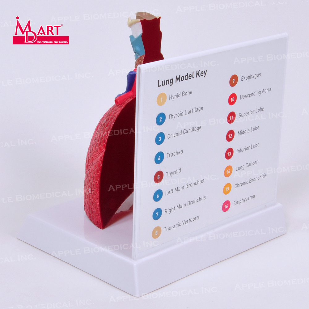 Buy Human Body Anatomy Removable Copd Lung Model For Medical Teaching ...