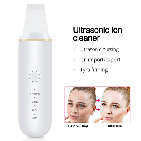Buy Ultrasonic Facial Skin Scrubber Deep Facial Cleaning Machine ...