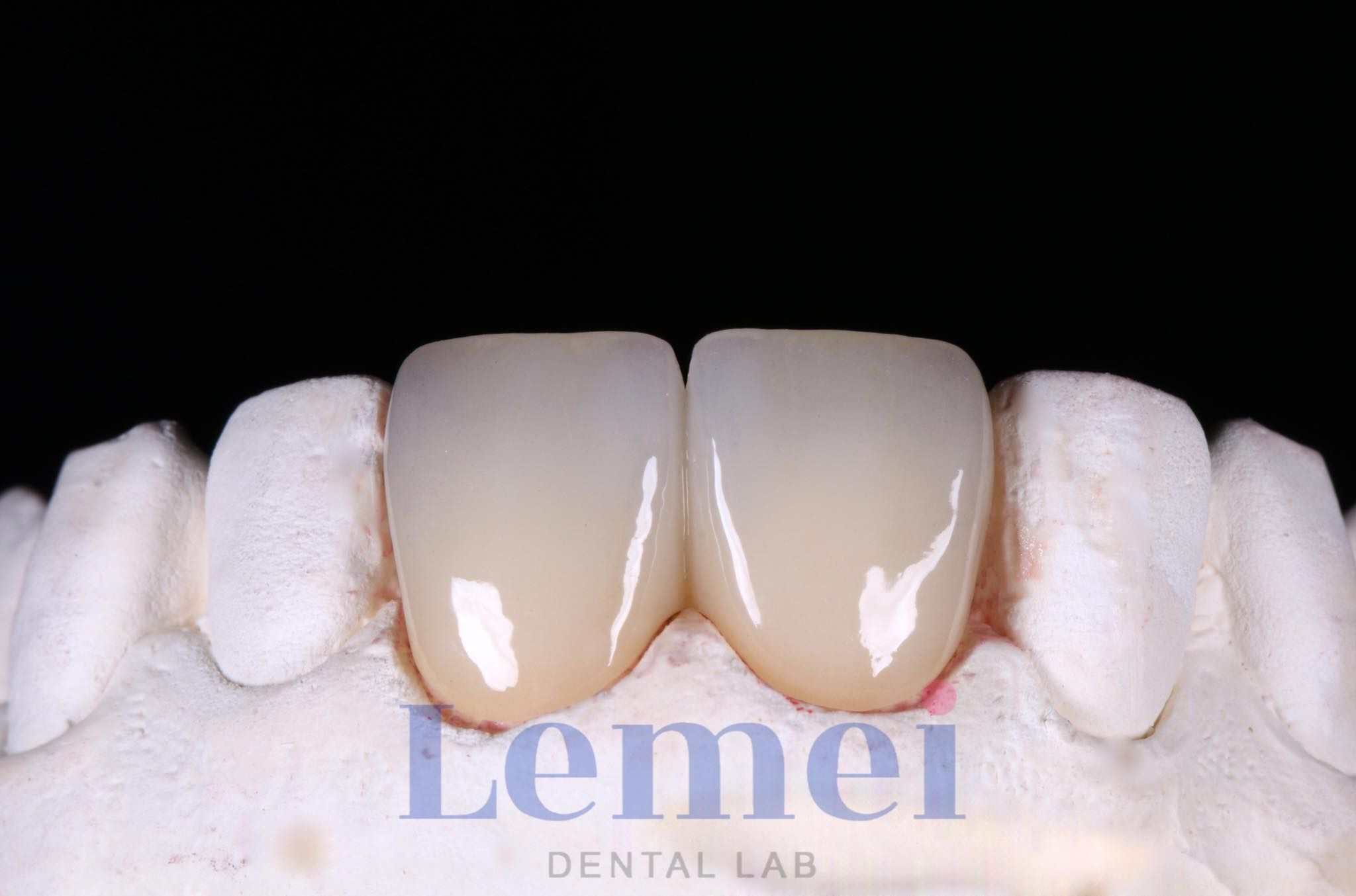 Buy Natural-looking Zirconia Crowns For Cosmetic Dentistry from Lemei ...